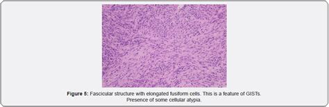 Juniper Publishers Journal Of Case Studies Case Report A Rare Case Of