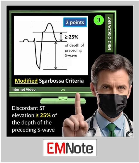 Sgarbossa Criteria Rfoamed911