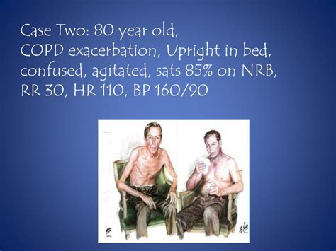 Ppt Dsi Delayed Sequence Intubation Powerpoint Presentation Free Download Id 1013921