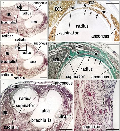 Later Development Of The Annular Ligament Of The Radius An 18 Week