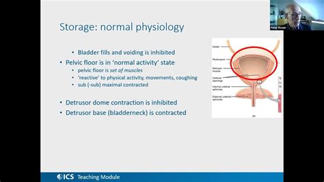 ICS 2021 Workshop 12 ICS Institute Urodynamics Clinical Urodynamic Round How To