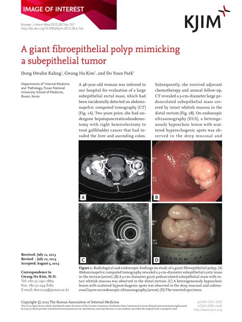 Pdf A Giant Fibroepithelial Polyp Mimicking A Subepithelial Tumor