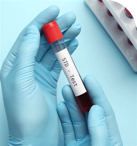 Std Testing And Treatment In Lewisville Tx Harveer S Parmar Md