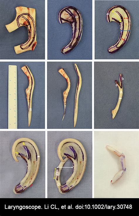 How To Quantitative Framework Fabrication With Autogenous Costal