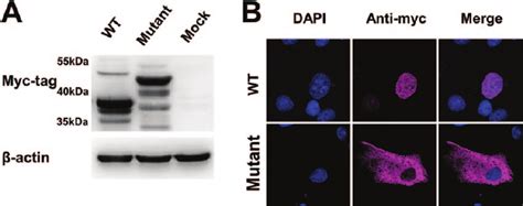 Expression And Subcellular Localisation Of The Wild Type And Mutant