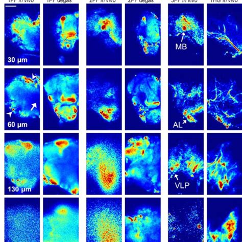 Living And Degassed Drosophila Brain Images Under Different Imaging