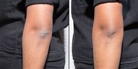 6 No Fail Ways To Avoid Ashy Skin