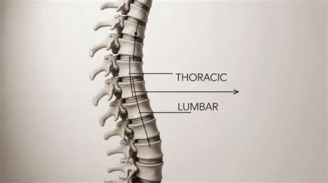 Thoracolumbar Scoliosis Guide To Symptoms And Treatment