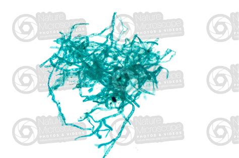 Bryophyta Moss Protonema 64x Bryophyta Mosses Bryophyta