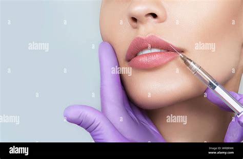 Cropped Sensual Female Lips Procedure Lip Augmentation Syringe Near