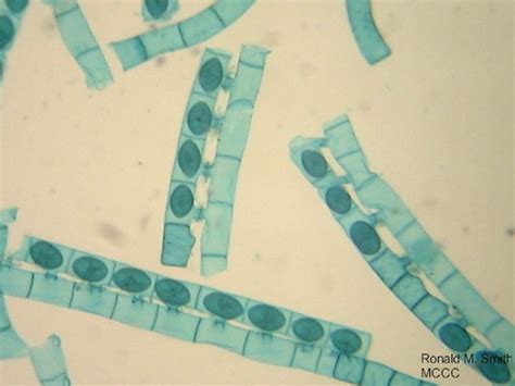 Lab Practical Flashcards Quizlet