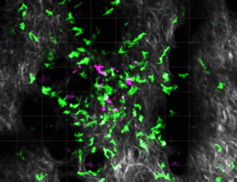 Cd4 T Cells Contribute To Antitumor Immunity By Bawden Et Al Hung