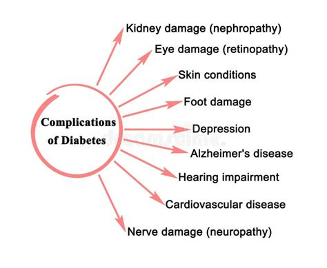 Nine Complications Of Diabetes Stock Illustration Illustration Of