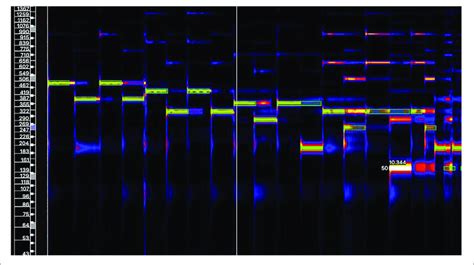 Visualization Of The Spectrogram And The Manually Corrected