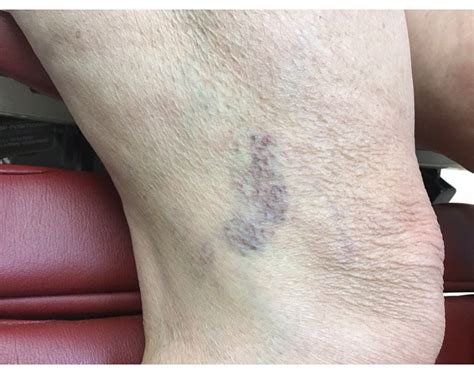 Before And Afters Aesthetic Dermatology