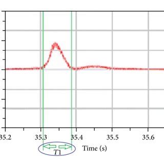 Phase Error In Proposed Design During The G Steps Download Scientific Diagram