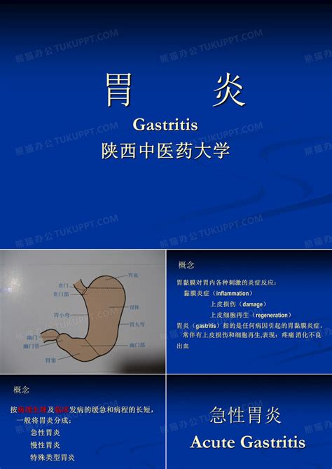 急慢性胃炎胃炎课件课件ppt模板下载编号lzpwxvvz熊猫办公