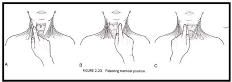 Pulmonary Assessment Guide Part 3 Neck And Chest Wall Palpation Flashcards Quizlet
