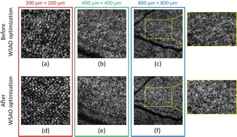 Lens Based Wavefront Sensorless Adaptive Optics Swept Source Oct