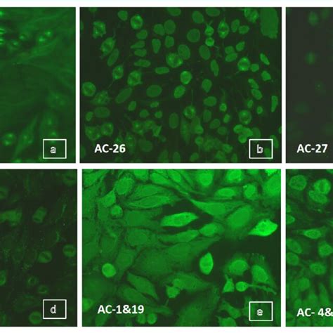 Composite Representation Of Mitotic Patternstop Panel And Mixed