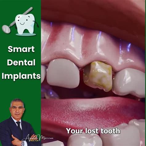 Smartimplants Dentaltech Healthcareinnovation Futureofdentistry Neeraj Tetaree