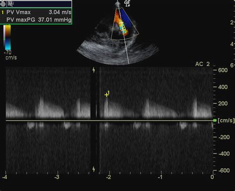Echocardiography