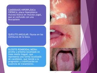 Lesiones De La Mucosa Oral Pptx
