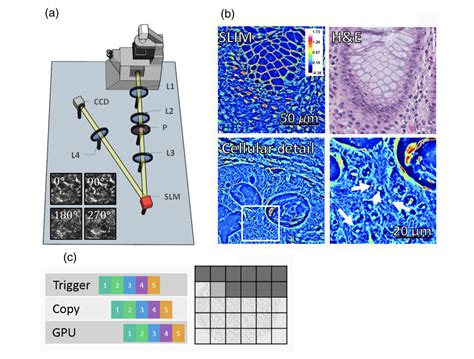 Label Free Tissue Scanner For Colorectal Cancer Screening Journal Of
