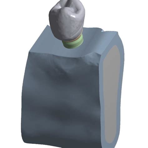 Three Dimensional 3d Finite Element Analysis Fea Models Of A Download Scientific Diagram