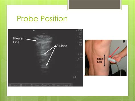 Ppt Journal Club Powerpoint Presentation Free Download Id3014994