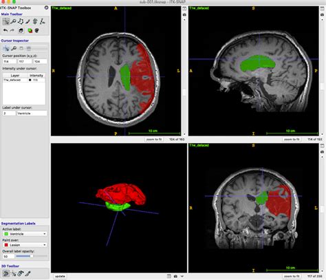 itk snap — neuroimaging core 0 1 1 documentation