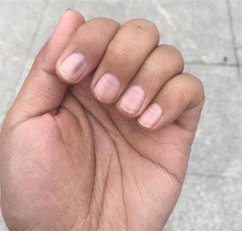 What Does Your Nails Says About Your Health Spic International College