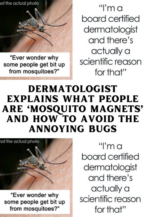 Dermatologist Explains What People Are ‘mosquito Magnets And How To