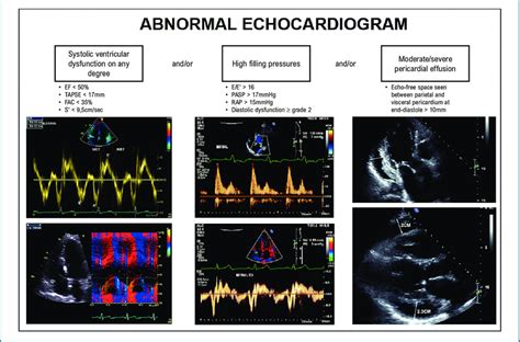 Criteria For Abnormal Echocardiogram Tapse Tricuspid Annular Plane Download Scientific Criteria For Abnormal Echocardiogram Tapse Tricuspid Annular Plane Download Scientific