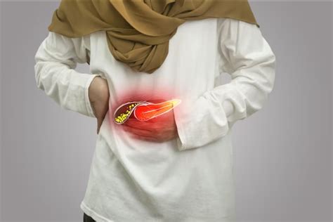 Facts About Gallstones You Must Know