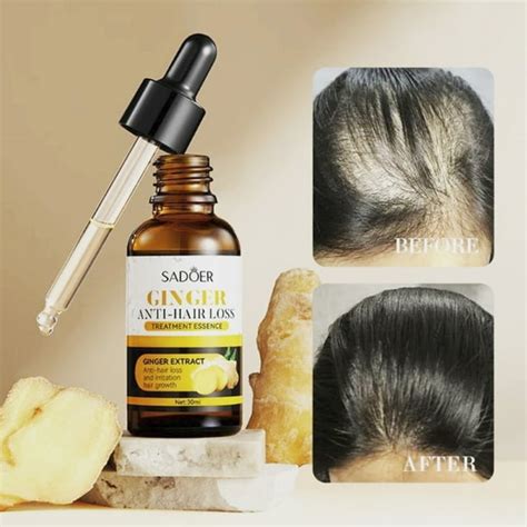 Serum Anticaída Sadoer Con Extracto De Jengibre Tratamiento Intensivo