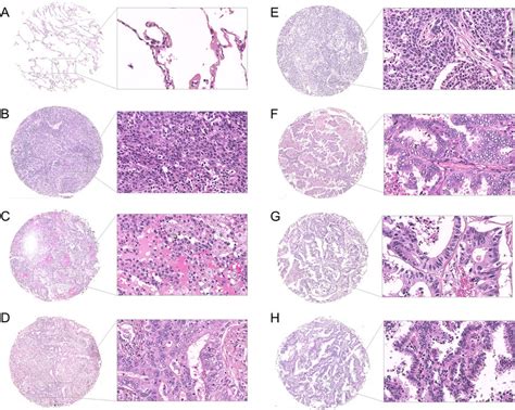 Morphological Analysis Of Human Lung Specimens Representative Images