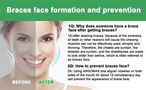 Amazon Com PCS Aligners Chewies Retainer Chewies Chewies Aligner