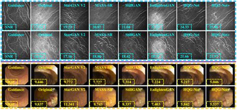 Visual Comparison Of Enhanced Results On Ccm And Colonoscopy Datasets Download Scientific