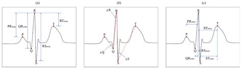 Efficiently Updating Ecg Based Biometric Authentication Based On Incremental Learning