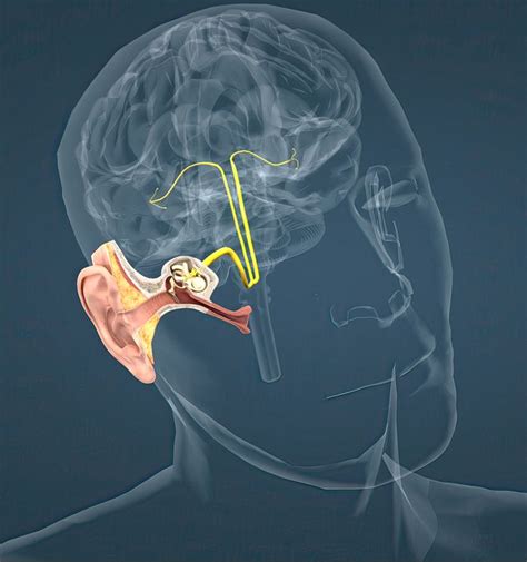 How Sound Processing Affects Your Health And Well Being Charlotte
