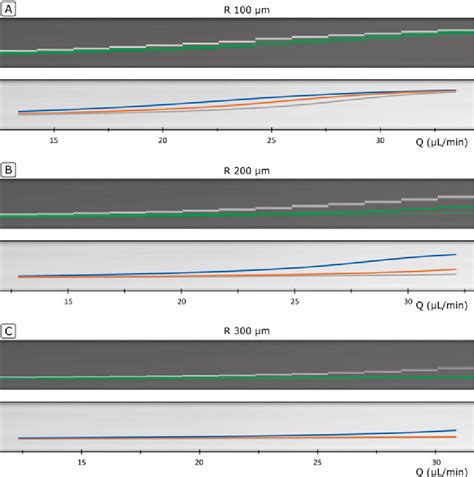 Figure 1 From Microfluidics For High Pressure Inertial Focusing Focusing Separation And