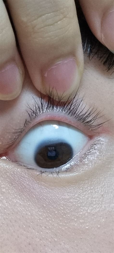 눈동자 테두리 회색 지식in