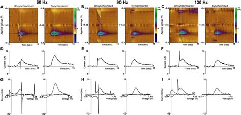Effect Of Stimulation Artifact With And Without Synchronization Between Download Scientific