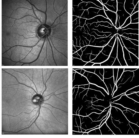 Figure 3 From A Publicly Available Vessel Segmentation Algorithm For