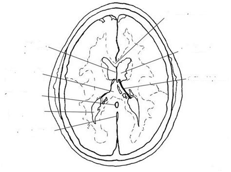 Axial Ct Slice 10 Diagram Quizlet