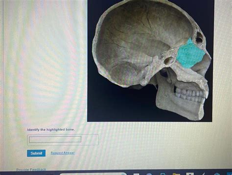 [answered] identify the highlighted bone submit provide feedback kunduz