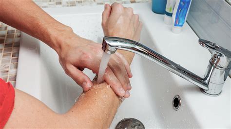 What To Do If You Get Stung By A Stingray How Treat A Stingray Sting