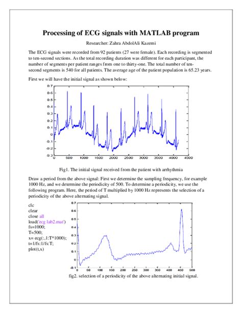 Pdf Processing Of Ecg Signals With Matlab Program