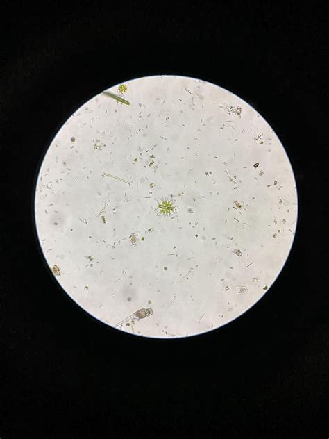 Desmids And Other Green Algae Rmicroscopy